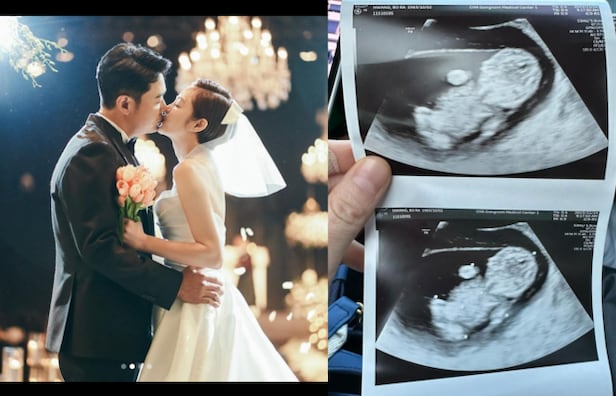 '임밍아웃' 황보라, 2세 성별은 아들?..태교에 전념ing (Oh!쎈 이슈) - 조선비즈